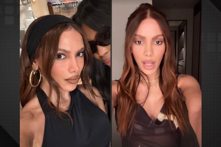 Anitta reaparece com "novo rosto" após procedimento e web reage: "Em ...