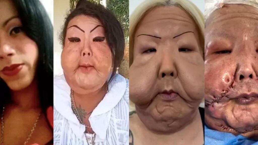 Juju do Pix enfrenta cirurgia arriscada e resultado surpreende a web